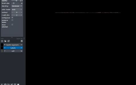 Napari Ilastik Segmentation Error Usage And Issues Imagesc Forum