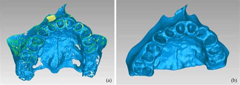 3d Model Of The Alveolar Bone A The Result Of Experiment 3 Download Scientific Diagram