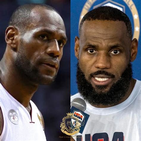 Lebron James Hair Transplant Rumours Of King James Hair Hair Center