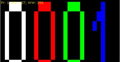 Dicom Is Easy Chapter 12 Pixel Data