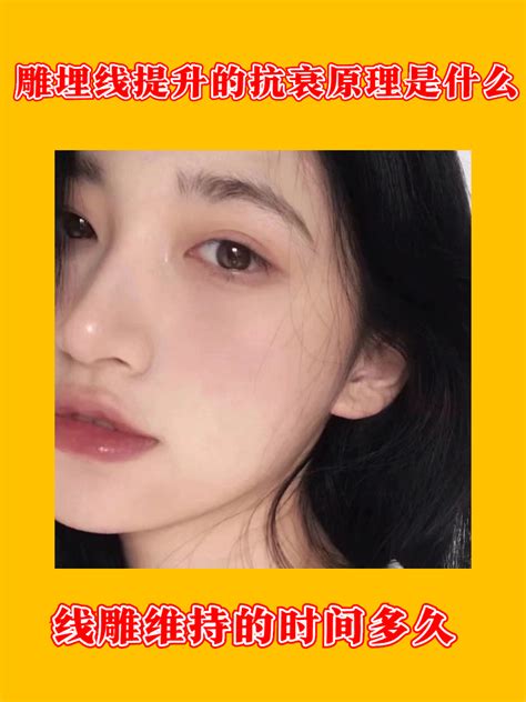 雕埋线提升的抗衰原理是什么，线雕维持的时间多久 哔哩哔哩