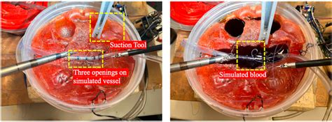 Figure 3 From An Adaptive Human Robotic Interaction Architecture For Augmenting Surgery