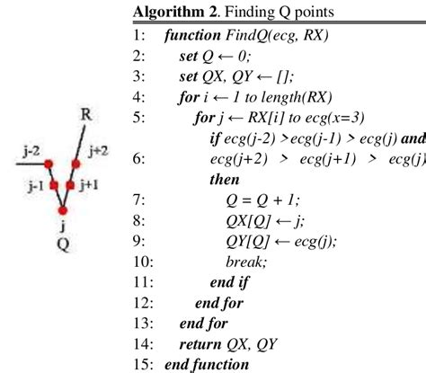 Detection Of Q Points Download Scientific Diagram