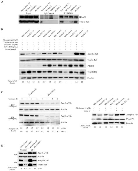 The Role Of Runx2 In Microtubule Acetylation In Bone Metastatic Breast