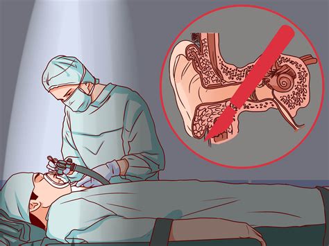 Labyrinthitis Exercises