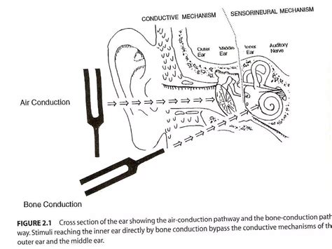 Tests For Auditory Assessment Pptx