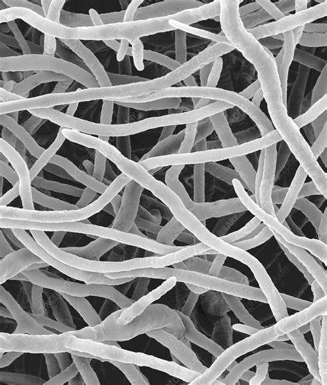 Filamentous Fungus Ascochyta Pisi Sem Stock Image C0370257