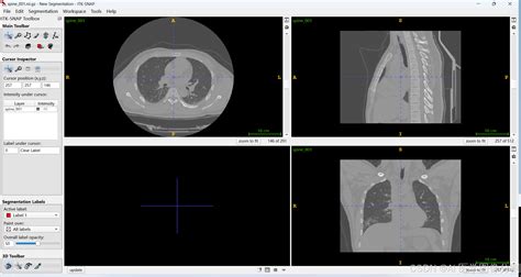 Nnunet 大模型学习笔记（续）：3dfullres 模型的推理、切片推理、计算dice系数nnunet库的单个nii文件推理 Csdn博客