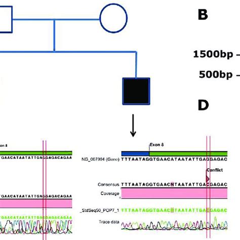 Novel Missense Mutation Identified In Exon 1 Of The Factor Viii Gene Download Scientific