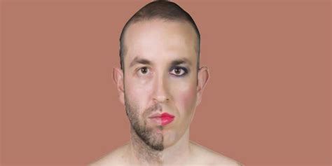 Sex Reassignment Complications Side Effect Of Sex Reassignment GRS