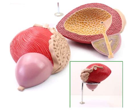 Buy Rexgel Educational Model Human Bladder Prostate Model 3 Times