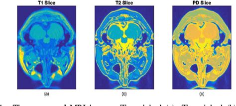 Figure 1 From Multi Contrast Mr Imagevolume Alignment Via Ecc Maximization Semantic Scholar