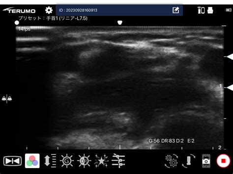 Kimura Migiude Object Detection Dataset By New Workspace Iybyy
