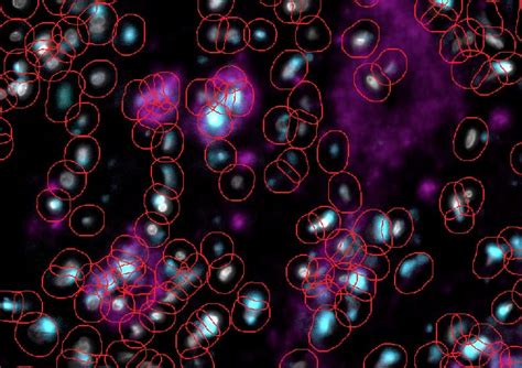 Taking Measurements Just Outside Cells In Qupath Image Analysis Imagesc Forum