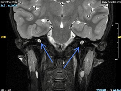 Mohammed Alnasser Msc Pmp On Linkedin When You Do Iac Mri Scan And