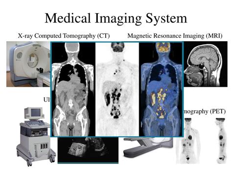 Ppt Medical Imaging Analysis Powerpoint Presentation Free Download