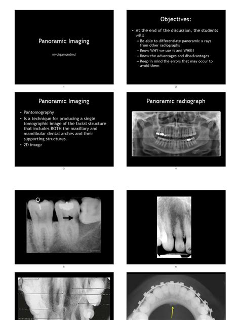 Panoramic Imaging Errors Pdf