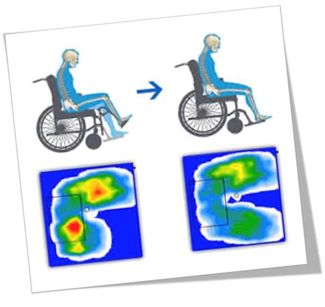 OCTH Seating Positioning Flashcards Quizlet