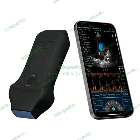 Jual Usg Wireless Wifi Echo Ultrasound Linear Cardiac Sector Probe Kab Tangerang Jamboe