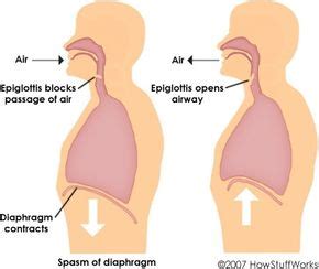How Hiccups Work Howstuffworks