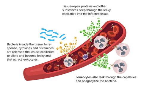 Inflammatory Response Varsity Education