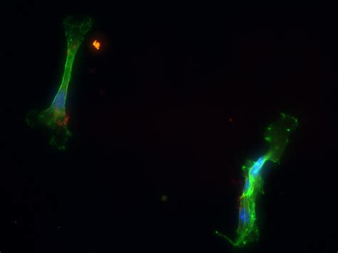 Calculating Line Intersects Using Imagej Image Analysis Imagesc Forum