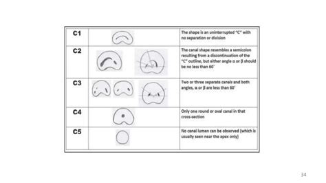 C Shaped Canals Pptx By Dr Amal Devadas Pptx