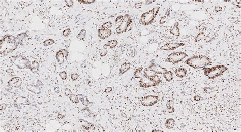 Msh6 Antibody 66172 2 Pbs Proteintech 武汉三鹰生物技术有限公司