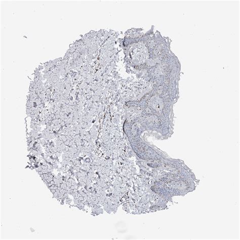 Tissue Expression Of Cd63 Staining In Skin The Human Protein Atlas