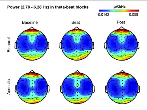 Scalp Distribution Of Eeg Spectral Power During Blocks With Download Scientific Diagram