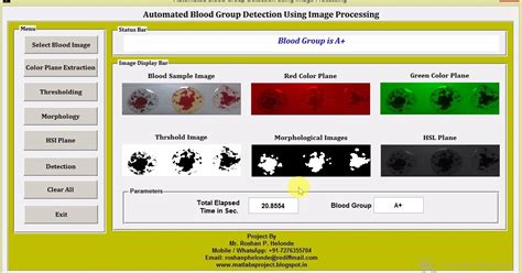 Blood Group Detection Using Image Processing Matlab Project With Source Code ENGINEERING PROJECTS
