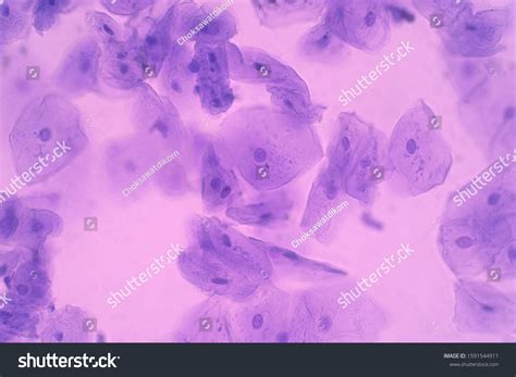 Human Epithelial Cells With Labels
