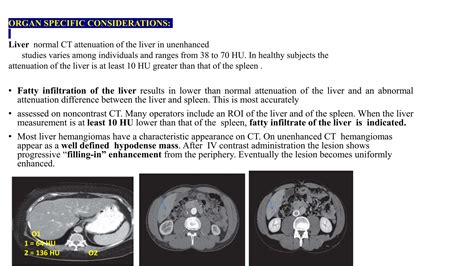 Section 1 Ct Abdomen And Pelvis By Doctor Aya Ali Taha Ppt