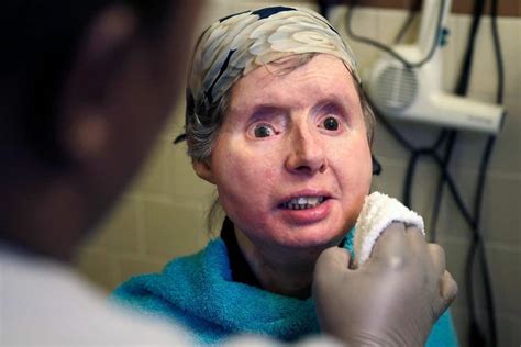 【閲覧注意】チンパンジーに素手で破壊された女性のビフォーアフターがやばすぎる ポッカキットポッカキット