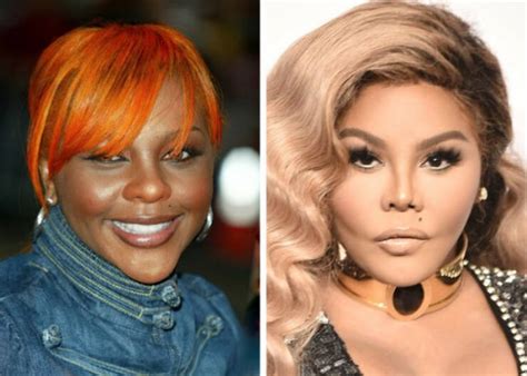 Celebrities Before And After Plastic Surgery Celebrities