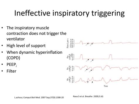 Ppt Patient Ventilator Asynchrony In Non Invasive Ventilation And