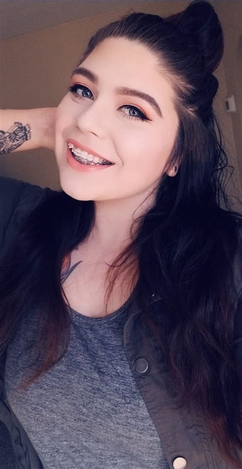 Embrace The Brace Braces