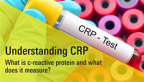 Crp And Cholesterol As Markers Of Heart Disease Risk Causes And Strategies For Management