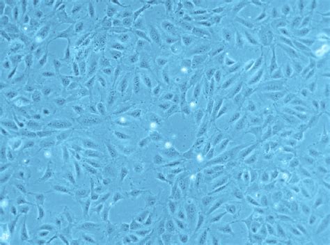 Human Umbilical Vein Endothelial Cells Huvec Promocell Cells