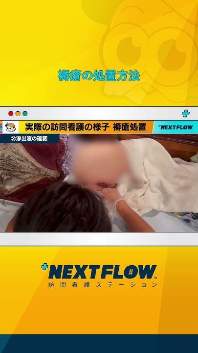 褥瘡処置 実際の様子 褥瘡 皮膚問題 看護技術 褥瘡処置 訪問看護 看護師 訪問看護師 おすすめ Nextflow訪問看護 Shorts Youtube