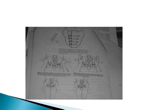 Pelvic Injuries Drsatish Ppt