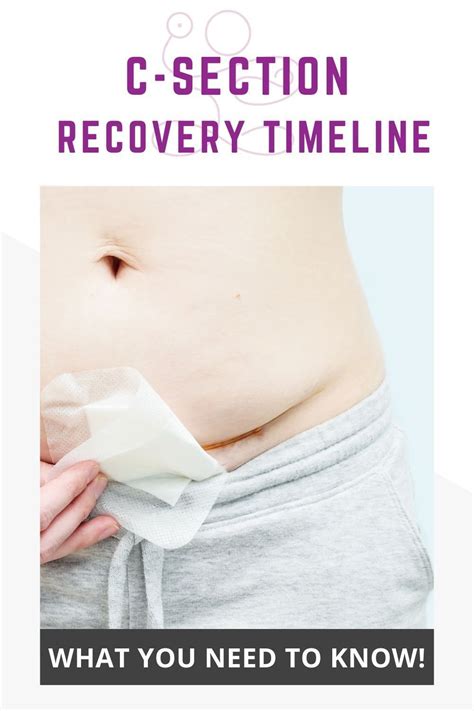 C Section Recovery Timeline And Return To Exercise Post Cesarean Artofit