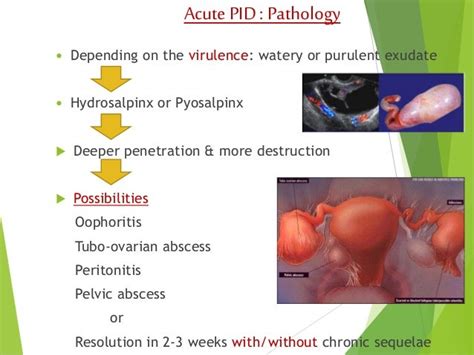 Pelvic Inflammatory Disease Pid