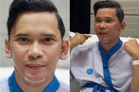 แมว จิรศักดิ์ ขึ้นเขียงดึงหน้าดูดไขมัน กลายเป็นเด็กหนุ่ม จนบอกว่าตัวเองคือ ณเดชน์ สยามรัฐ