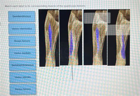 solved match each label to its corresponding muscle of the