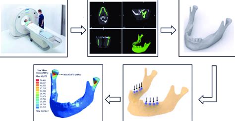 conversion of ct scan into a finite element model download