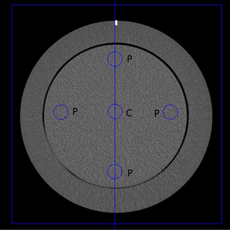 Different Reconstructions Of The Ctp404 Catphan Module Upper Part Fbp Download Scientific