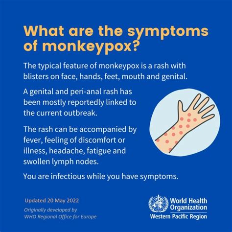 Monkeypox Symptoms Explained Know Prevention And Treatment Euparjan