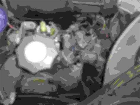 Tach Sensor Rebuild Ford Truck Enthusiasts Forums