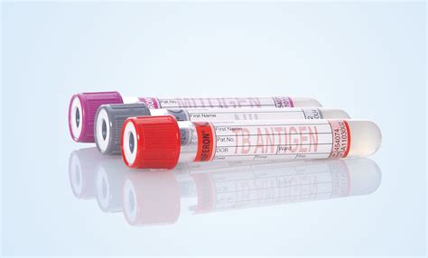 Quantiferon Tb Gold Qft Kit